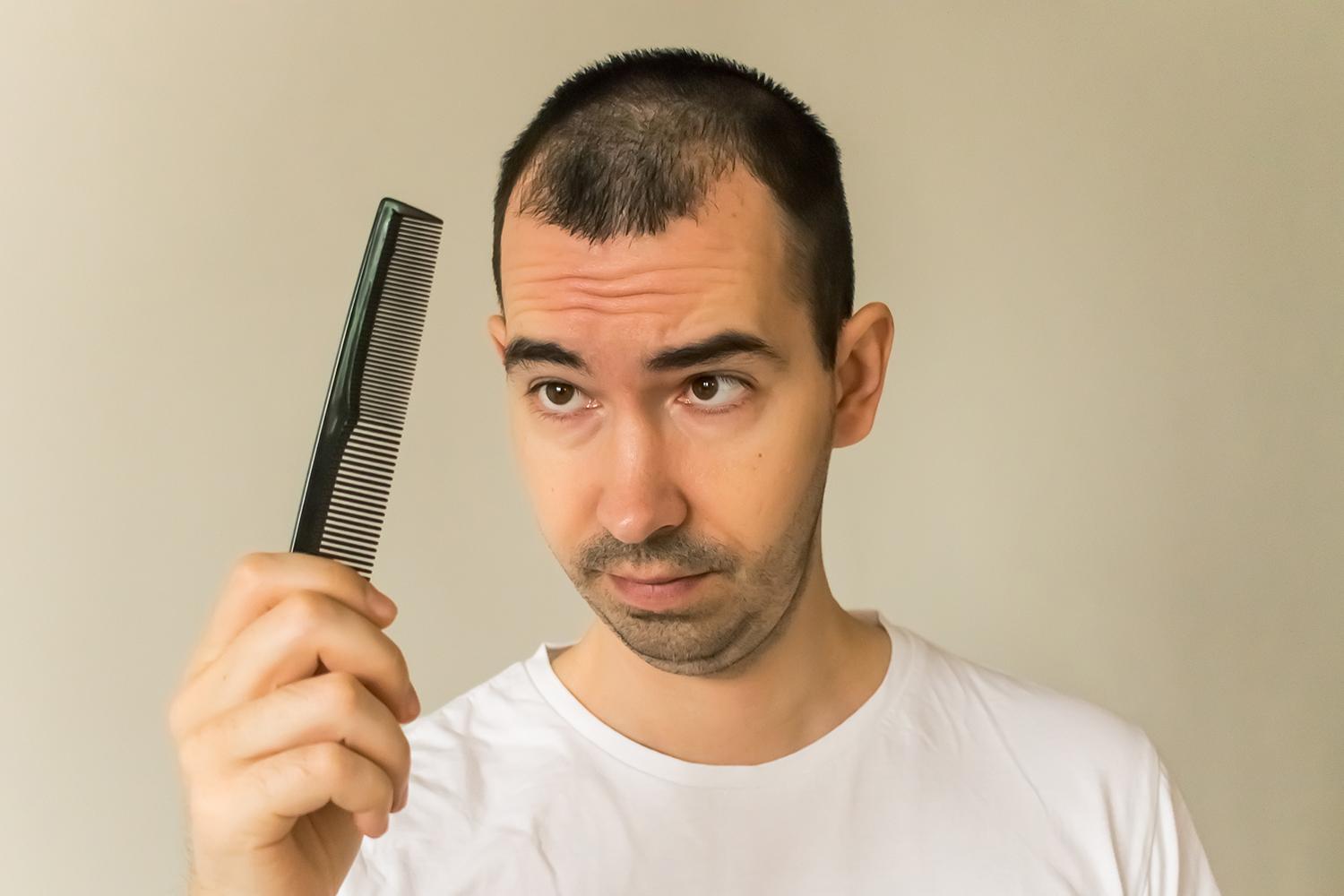 Natural Solutions for Thinning Hair | Fairborn Natural Foods